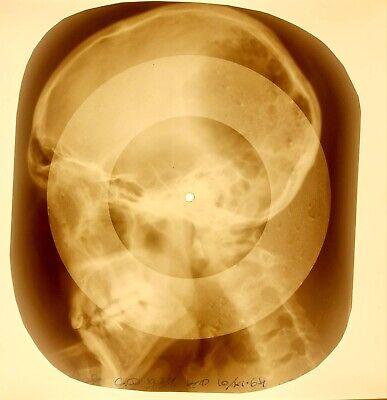 Gripsweat - USSR X-RAY SKULL ROENTGEN BONES RECORD ORIGINAL OLD RIBS 928